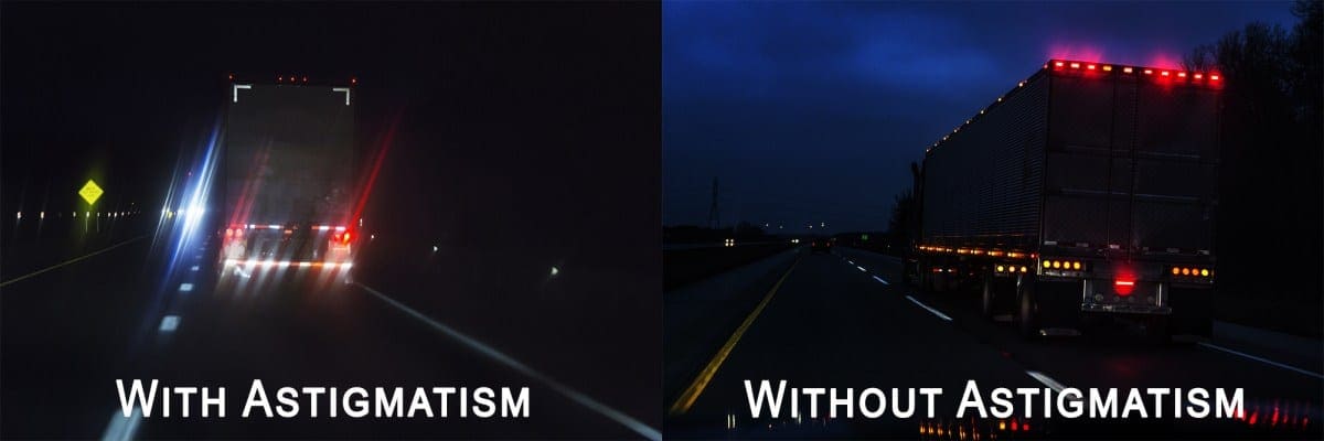 5 Things You Need to Know About Having an Astigmatism | Brinton Vision ...